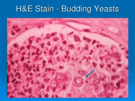 Ppt Mycology Powerpoint Presentation Free Download Id 1899063