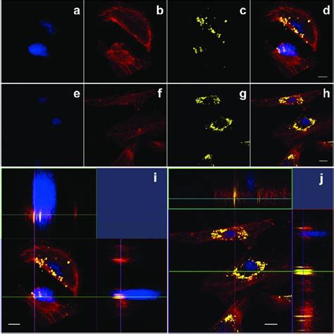 A Schematic Illustration Of The Preparation Of Pcl Dpp Pcl Download Scientific Diagram