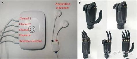创新突破！北理工团队智能肌电仿生手：虚拟肌电信号通道打破精确度瓶颈！ 知乎