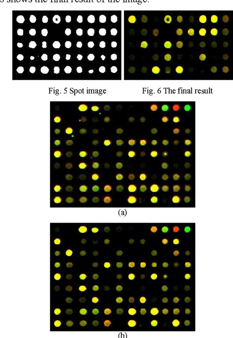 Figure 5 From Segmentation Of Cdna Microarray Spots Using K Means