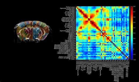 Resting State Functional Connectivity Iconeus