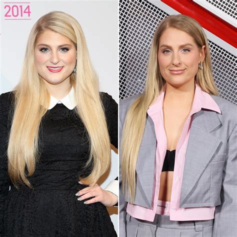 Meghan Trainor Reveals Plastic Surgery Plans Photos Of The Singers