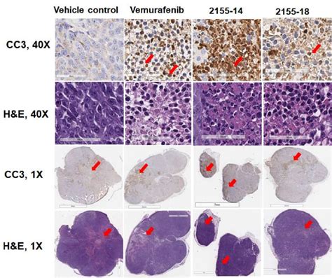 Immunohistochemical Analysis Of Protein Expression Of Cleaved Caspase 3 Download Scientific