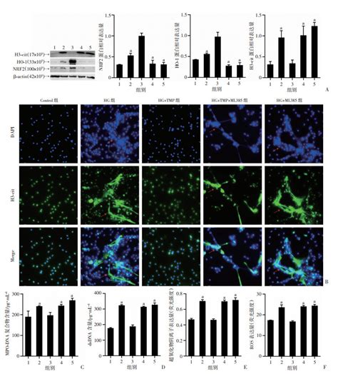 川芎嗪通过调控nrf2ho 1途径抑制高糖诱导的中性粒细胞外捕获网形成