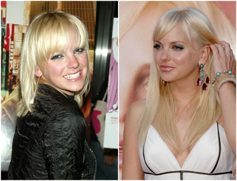 Anna Faris Lip Injections Heres What She Had To Say About Them