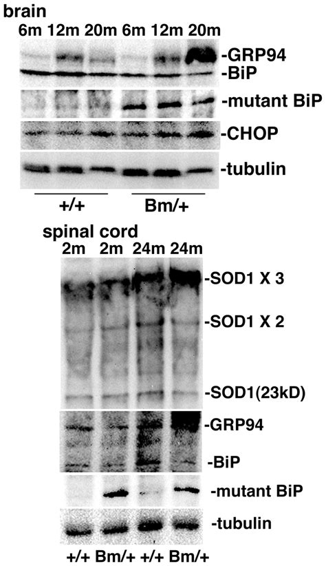 The Expressions Of Chaperones In The Mutant Bip Mice The Heterozygous Download Scientific