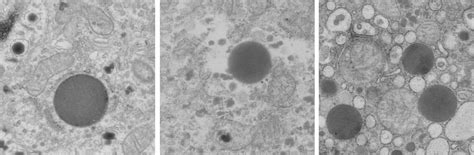 Lysosome Electron Micrograph Lysosome Electron Micrograph