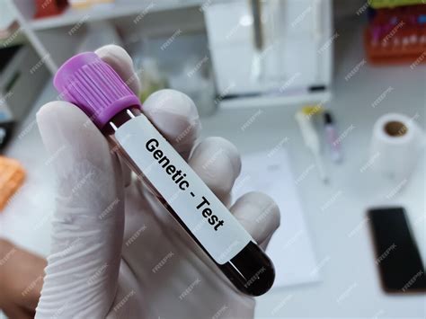 Premium Photo Scientist Holds Blood Sample For Genetic Testing Pcr