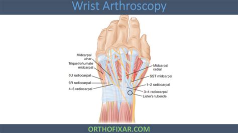 Wrist Arthroscopy • Easy Tutorial • Orthofixar 2026