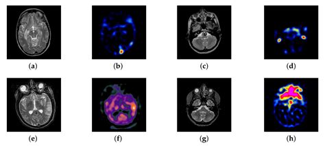 Entropy Free Full Text Multi Modal Medical Image Fusion Based On