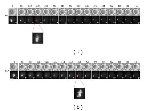Time Lapse Imaging From 304 To 416 Minutes Of Oocyte Culture A Sn Download Scientific