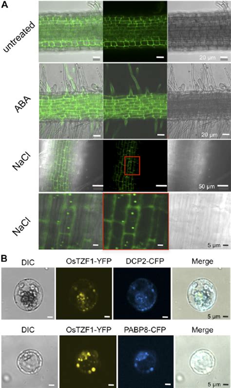 Subcellular Localization Of Ostzf1 And Colocalization With Cytoplasmic