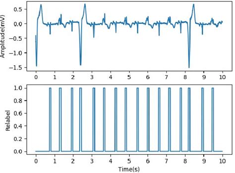 figure 1 from a lightweight r peak detection algorithm for noisy ecg