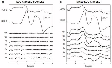 A A Five Second Epoch Of Eog And Eeg Sources B Mixed Eog And Eeg