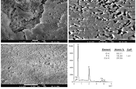 SEM Micrographs And EDS Result Of HAp Download Scientific Diagram