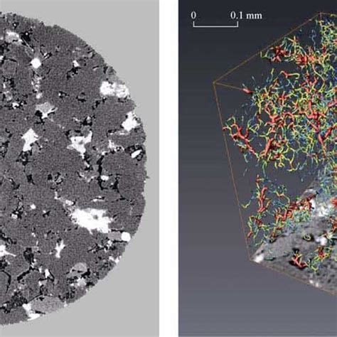 Ct Scanning Two Dimensional Slice Images And Three Dimensional Digital