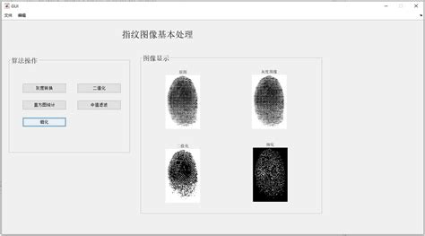 B Matlab指纹图像预处理 GUI界面 图像处理 索炜达电子