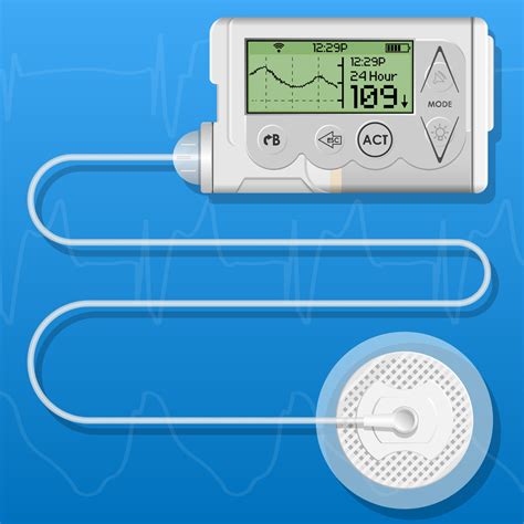 What Is An Insulin Pump Dr Rishi Shukla