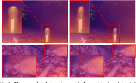 figure 1 from semhint md learning from noisy semantic labels for self