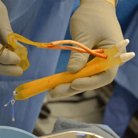 Pump Bump Removal Surgery At Jessica Gusman Blog