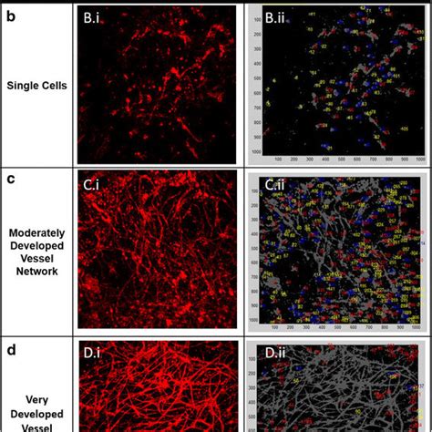 Matlab Analysis Of Vessel Network Complexity Matlab Analysis Of Download Scientific Diagram