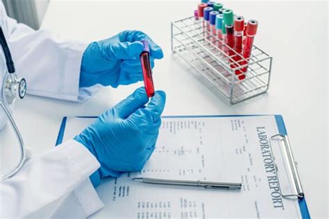 Haematology Tests Oak Diagnostic Center