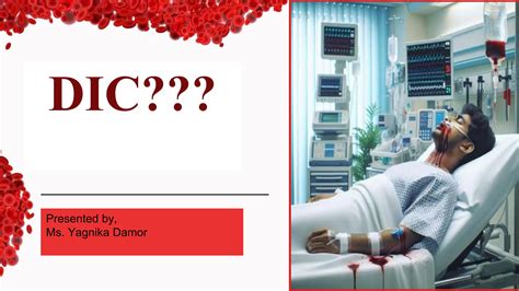 Disseminated Intravascular Coagulation A Comprehensive Guide For