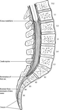 Cauda Equina And Conus Medullaris Syndromes Background Anatomy