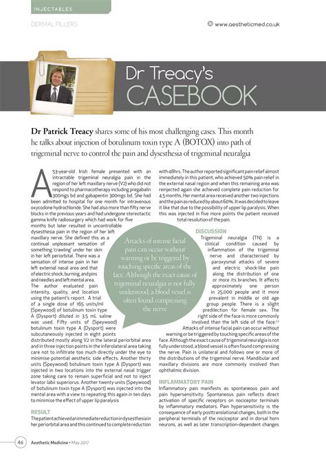 Using Botox For Trigeminal Neuralgia Pdf