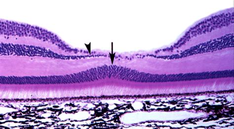 Macula Lutea Histology