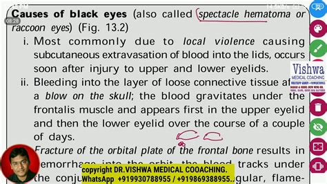 Spectacle Eyes Raccoon Eyes Black Eye Forensik Medicine By Dr Vishwa