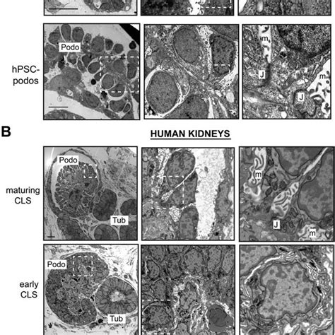 The Ultrastructure Of Human Pluripotent Stem Cell Hpsc Podocytes