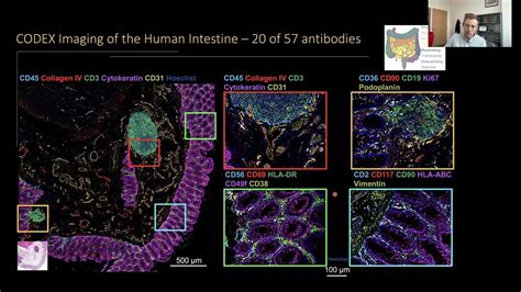 From Molecules To Multicell Modules Immune Mediated Tissue