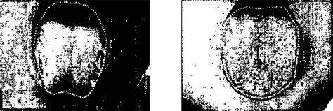 Figure 3 From On Automated Tongue Image Segmentation In Chinese Medicine Semantic Scholar