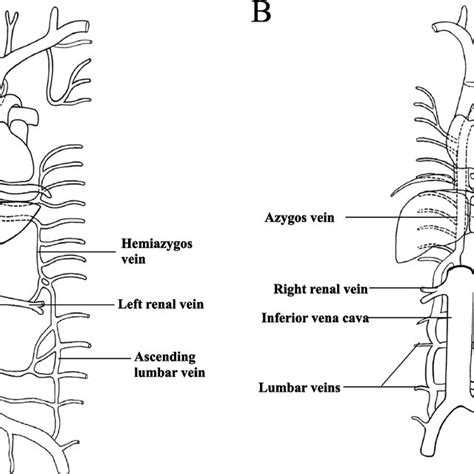 Schematic Sketch Of Venous System Picture A Shows That The Normal Ivc Download Scientific
