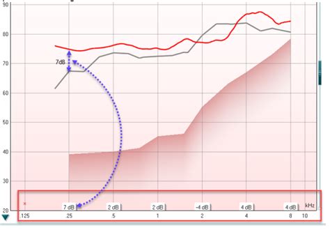 Affinity Compact Delta Values Interacoustics