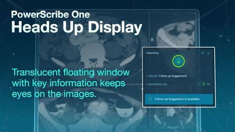 Powerscribe One Radiology Workflow And Reporting Solution Nuance