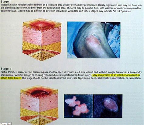 Issues Flashcards Quizlet