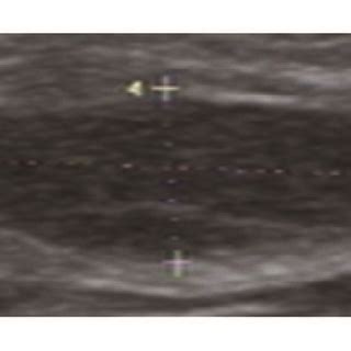 Example Of Preprocessing A The TCI Image B The Image After The Download Scientific