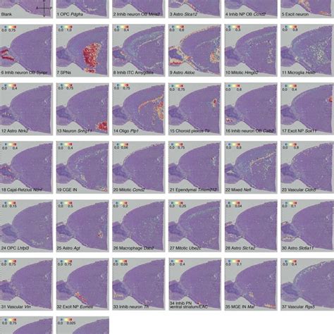 spatial transcriptomic mapping of cell type clusters spatial download scientific diagram