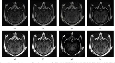 Figure 1 From Medical Image Fusion Based On Rolling Guidance Filter And Spiking Cortical Model