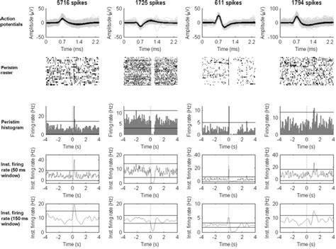 Examples Of Neuronal Firing Patterns During Spes For Each Column The