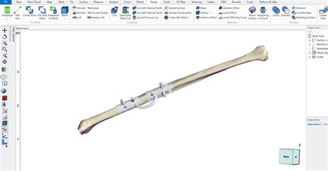Webinar Surgical Guide Design With The Mimics Innovation Suite