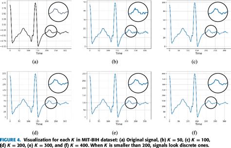 Figure 4 From Time Series Anomaly Detection Using Transformer Based Gan With Two Step Masking