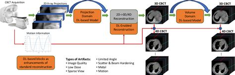 Figure 1 From Artifact Reduction In 3d And 4d Cone Beam Computed Tomography Images With Deep