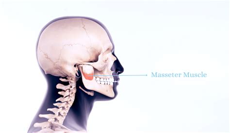 Masseter Muscle Pain Treatment Aca Acupuncture And Wellness