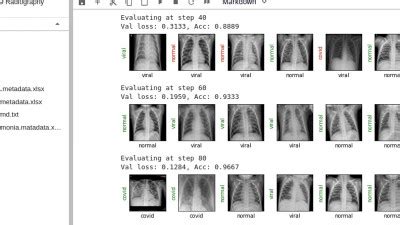 Corspedia Detecting COVID With Chest X Ray Using PyTorch