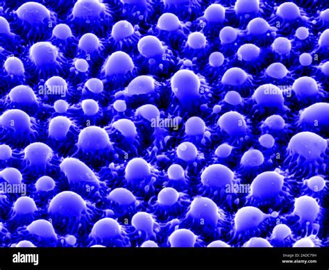 Nanostructures On Tantalum Coloured Scanning Electron Micrograph Sem