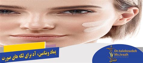 پماد ویتامین آ د برای لکه های صورت کلینیک جراحی زیبایی ایواز