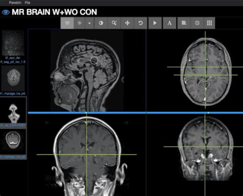 Best Dicom Viewers For Windows Macos Web And Mobile 2024 Radiogyan